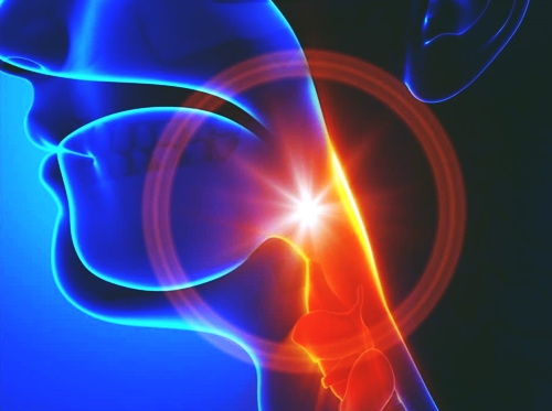 mal de gorge pourquoi